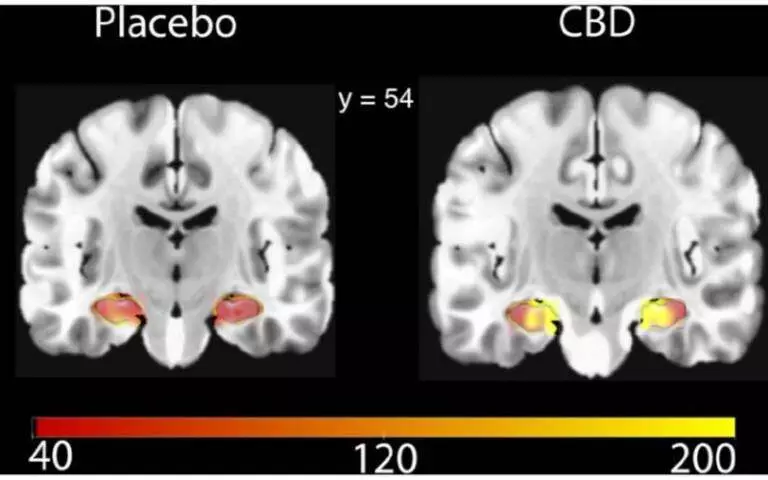 En dosis CBD øger blodgennemstrømningen til hjernen 1287_1