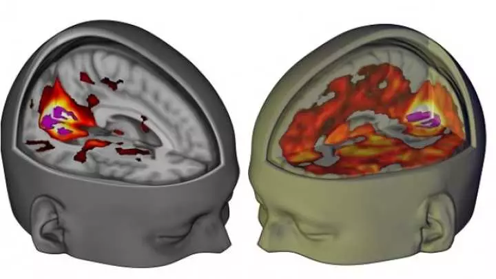 Tyrėjai pirmą kartą pavaizdavo smegenis naudojant LSD