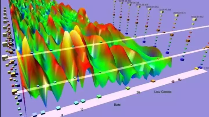 Gipakita sa Brain Waves nga ang DMT Sama sa 'Pagdamgo Sa Imong mga Mata nga Bukas'