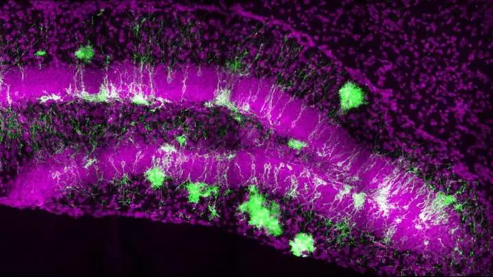 A tudósok felfedezik az új neuronok forrását az egész élet során az agy hippokampuszában
