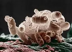 Come i batteri nel nostro intestino influenzano le nostre voglie di cibo 1397_1