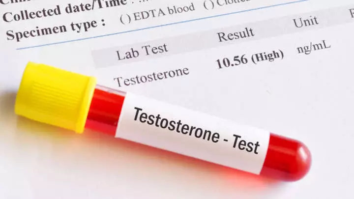 Testosteronu Engellemek Covid-19 Ölümlerini Azaltabilir Ama Erkekler Kabul Edecek mi?