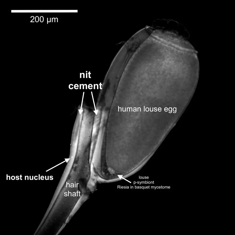 Ang mga Kuto sa Ulo Naghatag Labing Maayo nga DNA sa Tawo nga Gikuha Gikan sa Mga Mummies 1583_1