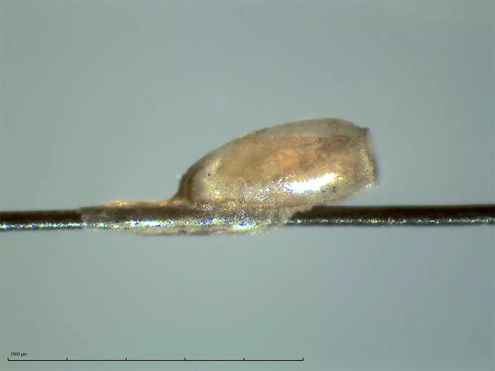 Kopfläuse liefern die beste menschliche DNA aller Zeiten, die aus Mumien extrahiert wurde 1583_2