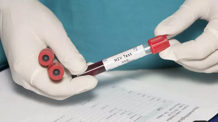 HIV'i Önlemek İçin İlk Enjekte Edilebilir İlaç FDA Tarafından Onaylandı