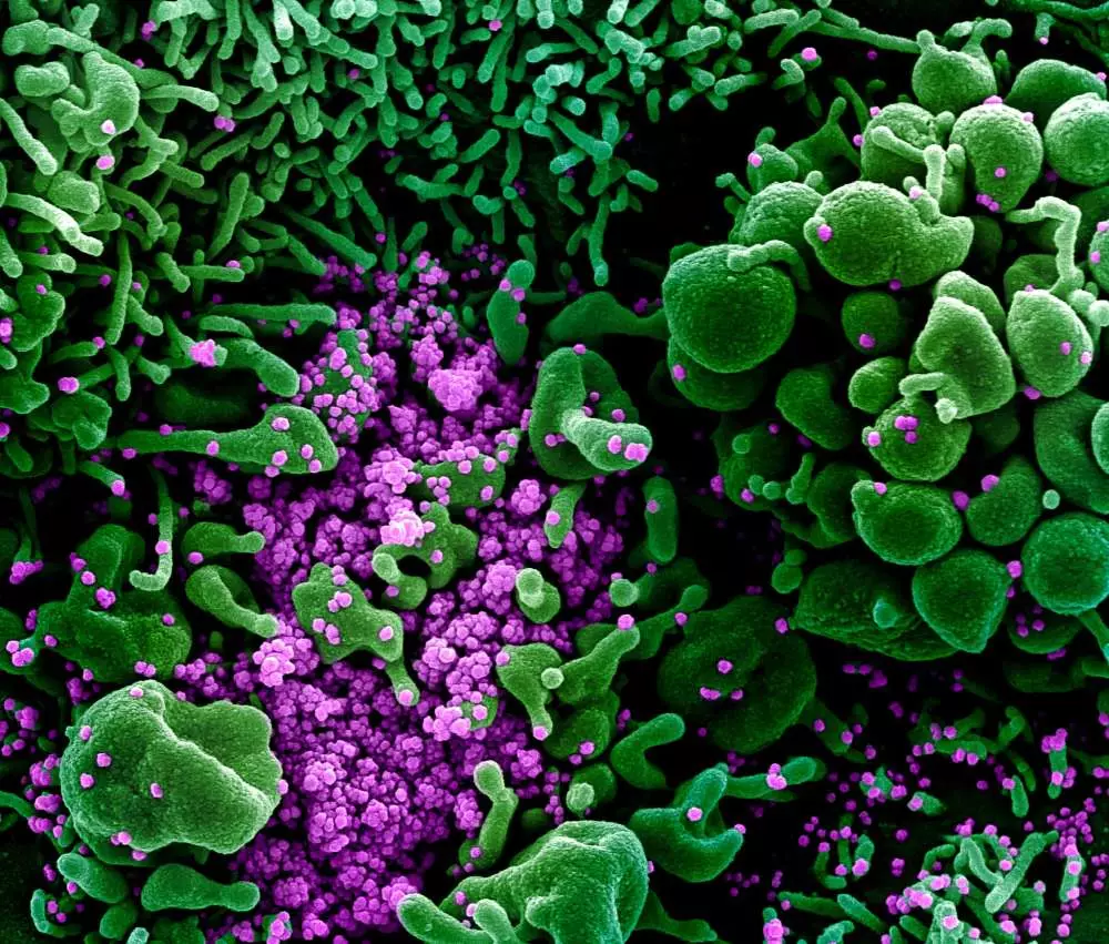 Nowe obrazy pokazują, jak nowy koronawirus „zabija” ludzką komórkę 1957_2
