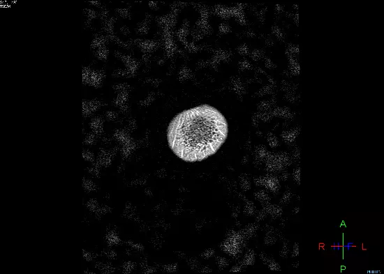 بۇ مەھسۇلاتلارنىڭ MRI سىكانىرلاش سوۋغاتلىرى كىشىنى ھەيران قالدۇرىدۇ 2706_15