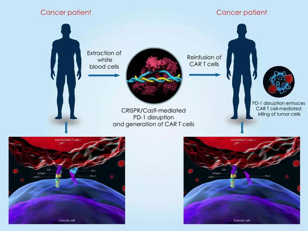 Pirmiesiems JAV vėžiu sergantiems pacientams taikomas CRISPR naujas genų redagavimo tyrimas 2829_1