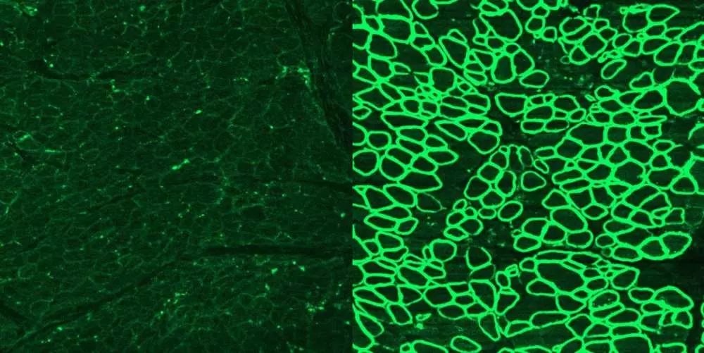 CRISPR Ivugurura Ryakosoye Dystrofi Yimitsi Yimbwa