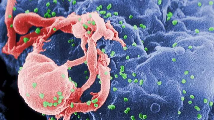 Orang Kedua Pernah Sembuh Daripada HIV