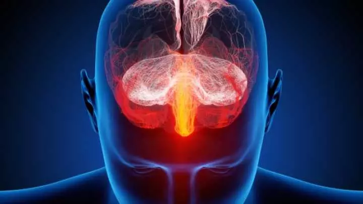 Identification d'un réseau cérébral reliant la maladie d'Alzheimer et la schizophrénie