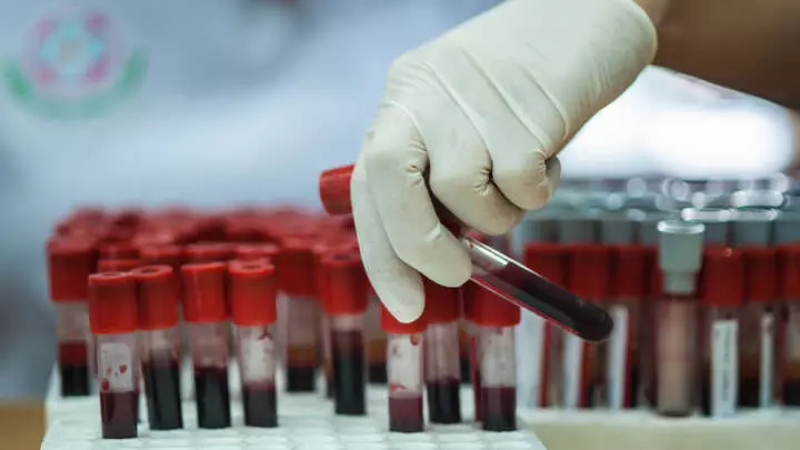 ไมโครพลาสติกที่พบในเลือดมนุษย์ในการศึกษาครั้งแรก