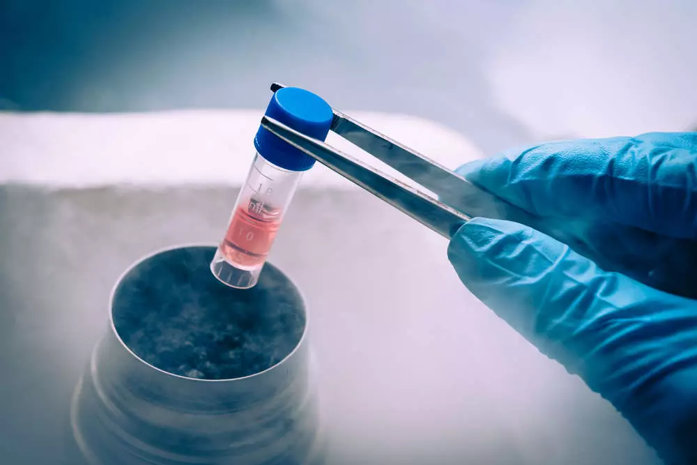 Forscher verwendet CRISPR, um DNA gesunder menschlicher Embryonen in umstrittener Weltneuheit zu bearbeiten 4771_1