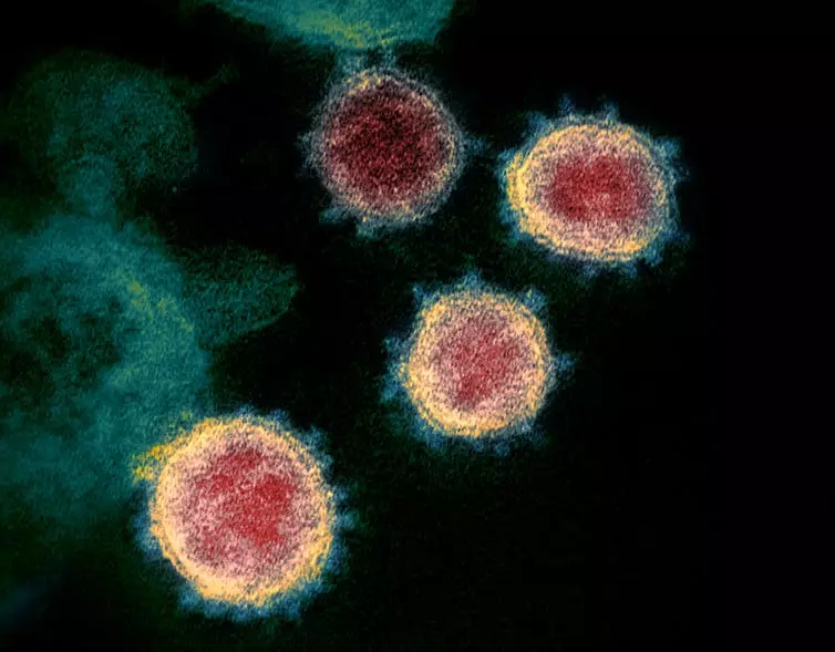నాలుగు SARS-CoV-2 వైరస్ కణాలను చూపుతున్న ట్రాన్స్మిషన్ ఎలక్ట్రాన్ మైక్రోస్కోప్ చిత్రం.