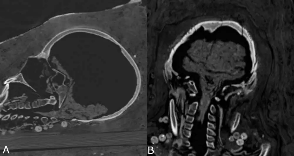 De nouveaux scans de momies égyptiennes révèlent un cerveau et d'autres organes à l'intérieur 5629_2