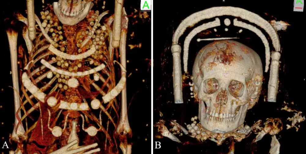 De nouveaux scans de momies égyptiennes révèlent un cerveau et d'autres organes à l'intérieur 5629_3