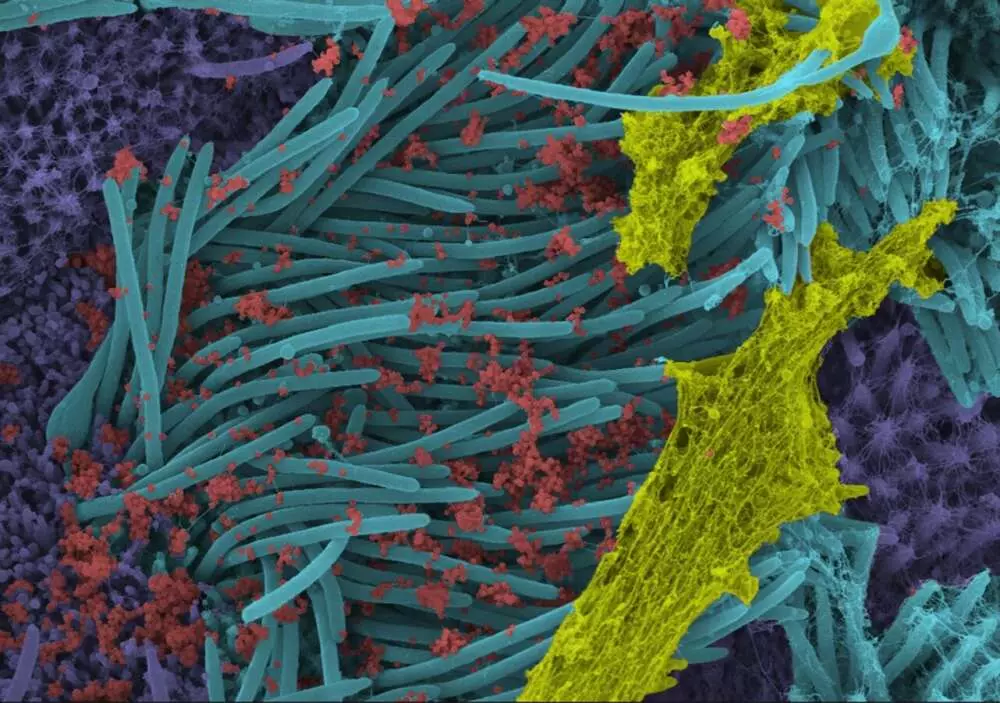 Esta imagen muestra el SARS-CoV-2 conquistando una célula pulmonar humana 6251_1