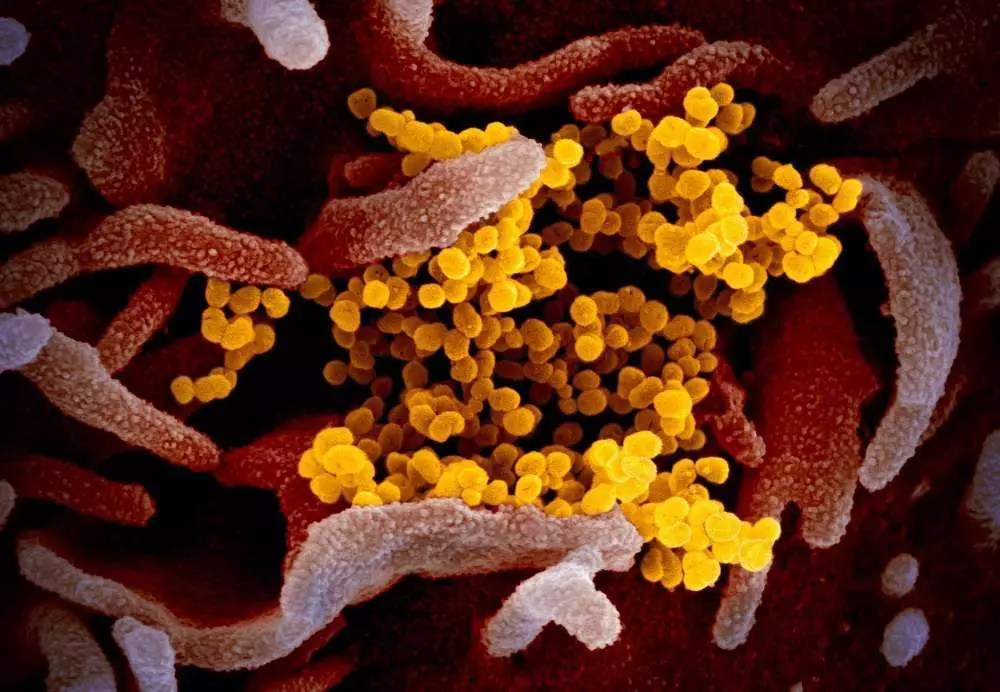 Coronaviruset kan överleva i luften i flera timmar och på ytor i tre dagar, föreslår studien 6376_1