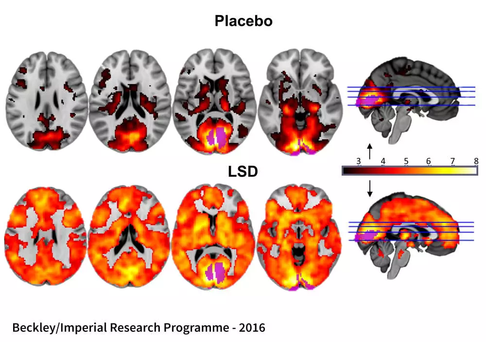 Här är varför LSD-mikrodosering kan bli nästa stora genombrott inom mentalvården