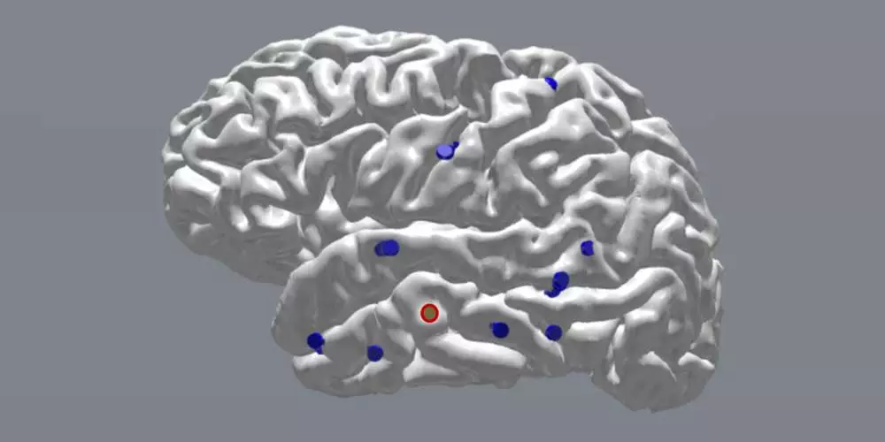 研究は、タイミングの良い電気的脳刺激が記憶を高めることを示唆しています 6916_1