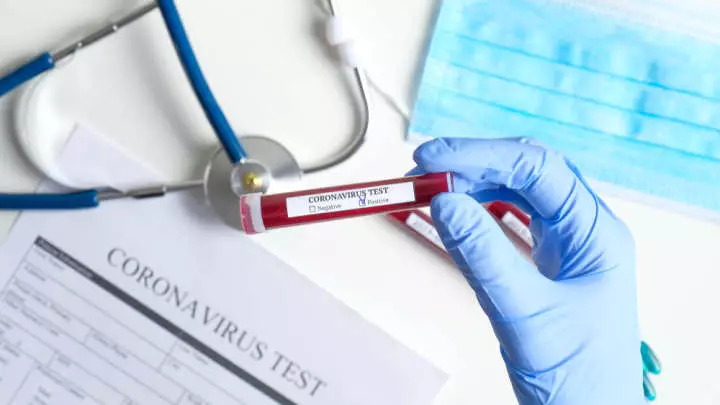 “Neapmierinoši” rezultāti liecina, ka HIV ārstēšana nav efektīva pret koronavīrusu