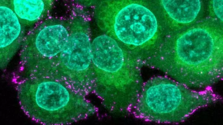 Baliteke COVID-19 gure sistema immunologikoa gure aurka erabili izana denbora guztian